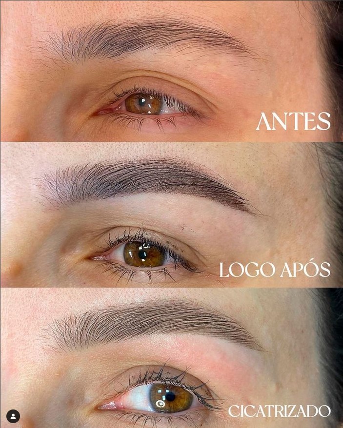 O que é a técnica Ombré Shadow na Micropigmentação